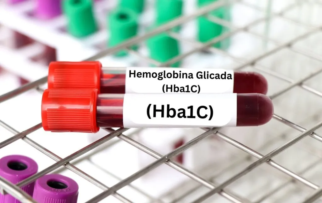 Hemoglobina Glicada (Hba1C): Exame, Para que Serve
